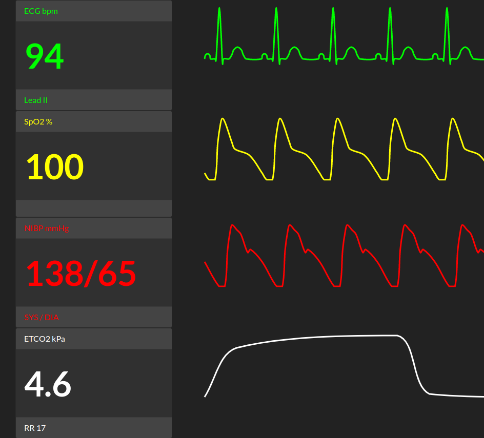Start | ResusMonitor - Simulation Patient Vitals Monitor